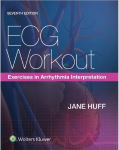 Ecg Workout Exercises In Arrhythmia Interpretation Free Download UPDATED