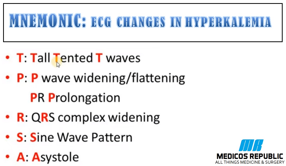 Hyperkalemia ECG Changes Mnemonic [With ECG Strips]