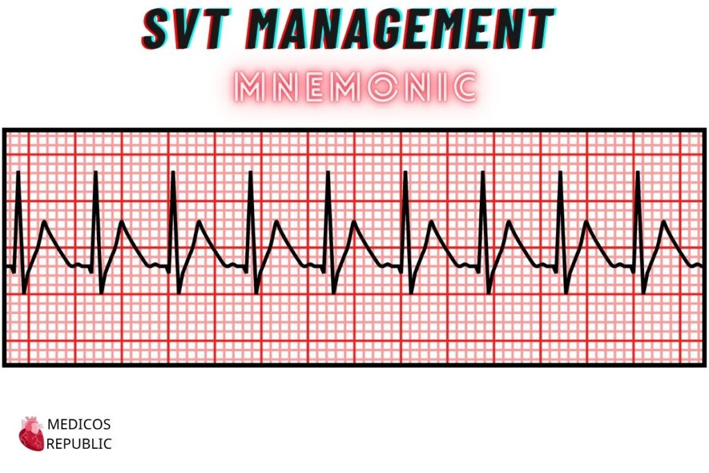 Supraventricular Tachycardia (SVT) Management Mnemonic | Bibliobazar ...