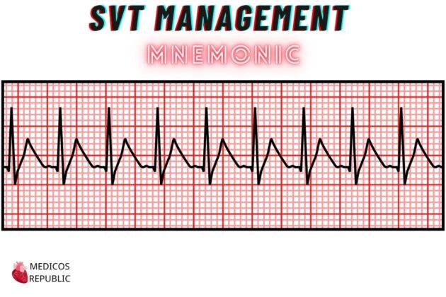 Supraventricular Tachycardia (SVT) Management Mnemonic | Bibliobazar ...